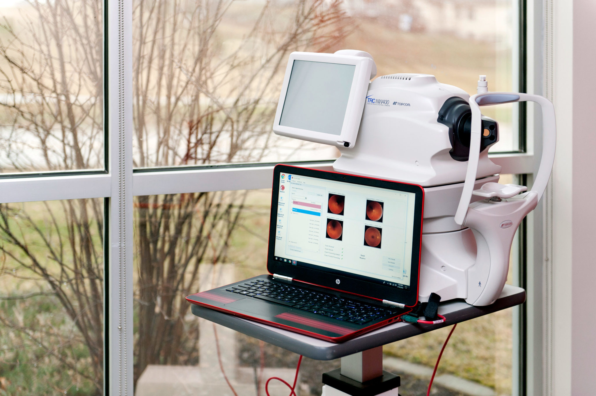 LumineticsCore® (formerly known as IDx-DR) Pivotal Trial - Digital ...