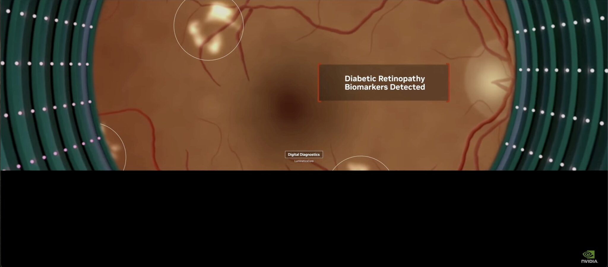 NVIDIA Spotlights Digital Diagnostics as AI Healthcare Pioneer at GTC 2025